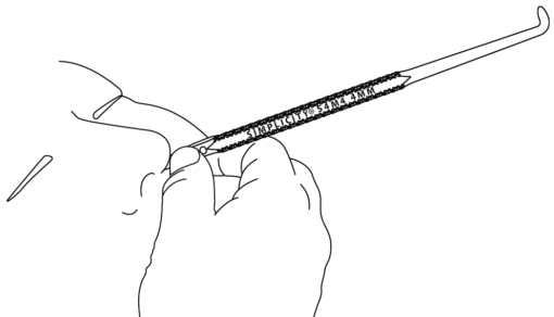 Sinus Dilator Instructions - Simplicity Dilators